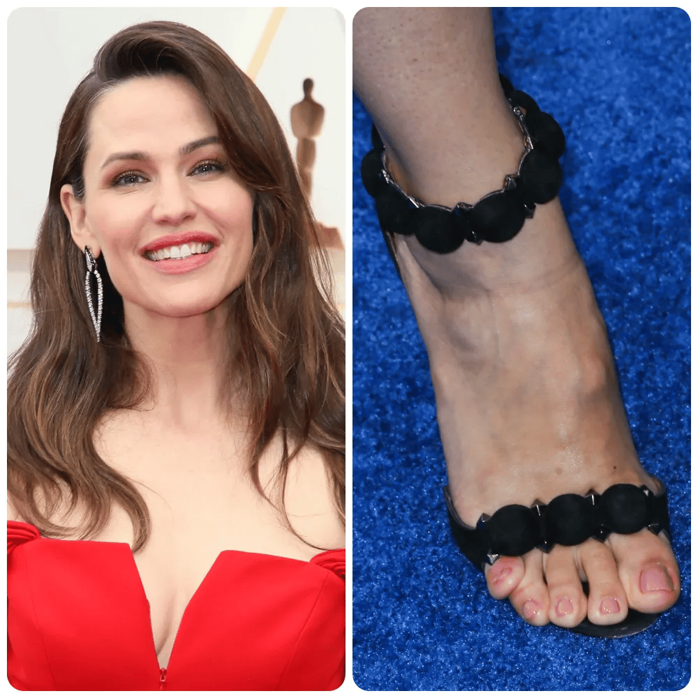 You Might Not Have Noticed These Deformities On These Famous People ...